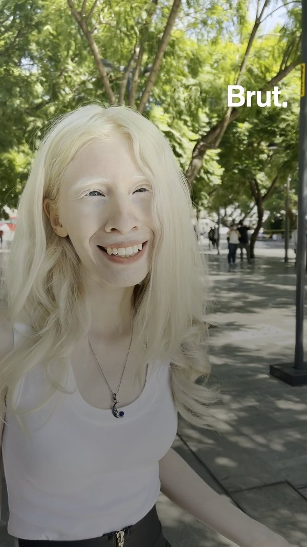Meet Ruby Vizcarra: the model finding beauty in her albinism | Brut.